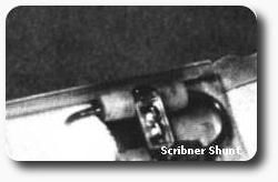 Historie der Hämodialyse